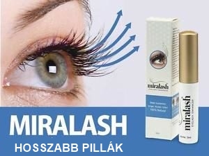 Visszér kezelése, visszeres láb gyógyítása, visszérkezelés otthon